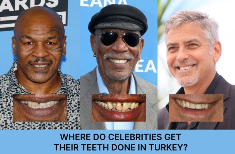 Where do celebrities get their teeth done in Turkey?